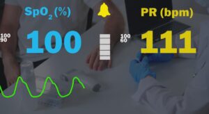 What Is an Overnight Oximetry Test - Everything You Need to Know