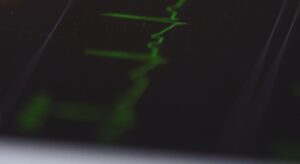 What Is an Overnight Oximetry Test - Everything You Need to Know