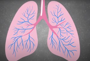 CPT and Diagnosis Codes for Bronchoscopies - Tips for Accurate Billing